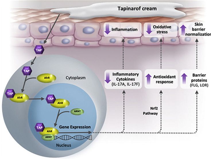 牛皮癣的局部治疗